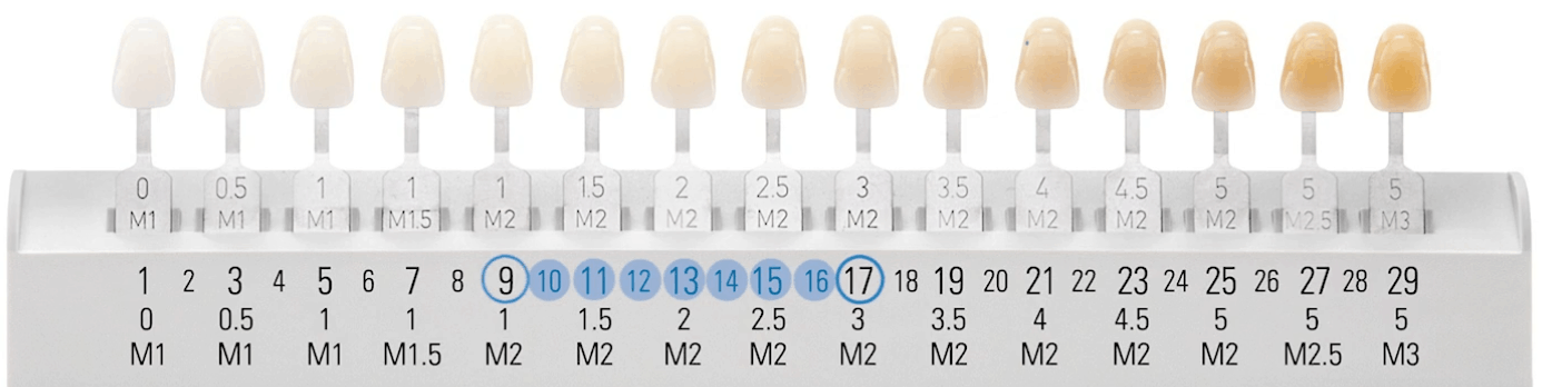 4 Reasons why ZOOM! Whitening is right for you